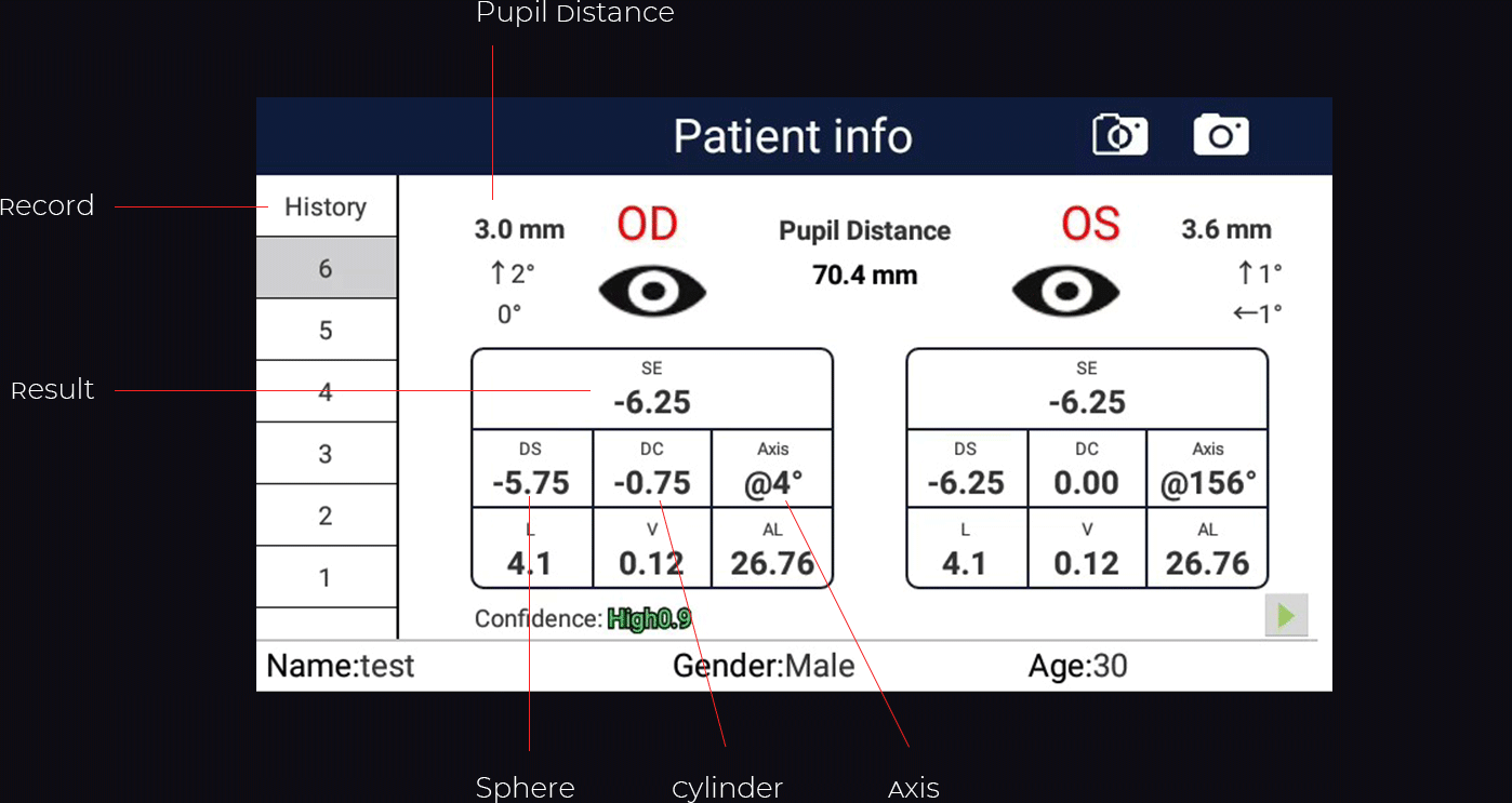 Microclear Hand Held AutoRefractor/Vision Screener – OcuRx