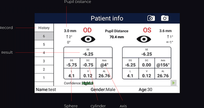 Microclear Hand Held AutoRefractor/Vision Screener – OcuRx